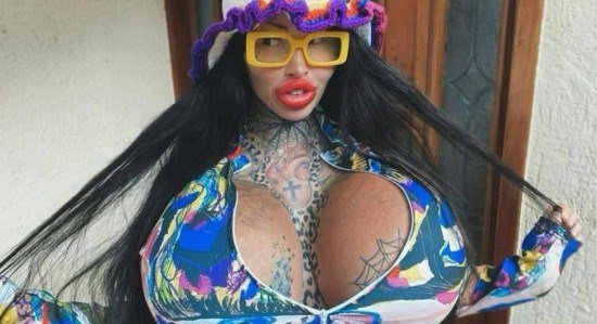 Influencer ‘viciada em plásticas’ já gastou mais de 500 mil e quase morreu durante procedimento